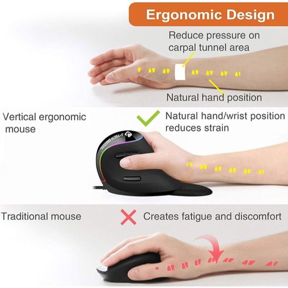 Other | Digital Ergonomic Mouse With Wired Connection Removable Palm ...